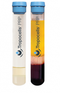 Tropocells PRP - Transcend Biologics