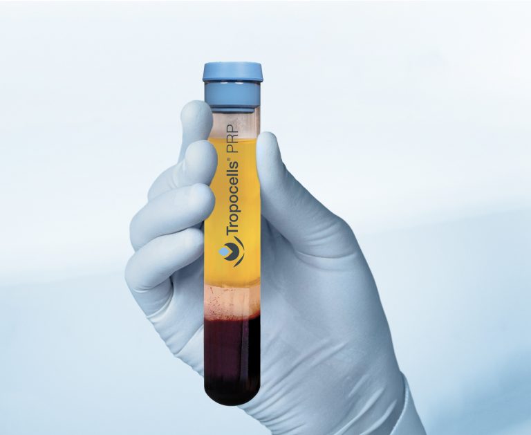 Tropocells PRP - Transcend Biologics